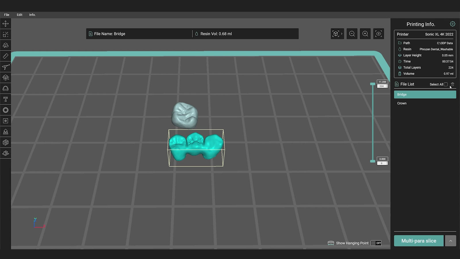 Phrozen DS Slicer | Fast & Accurate Dental 3D Printing Software